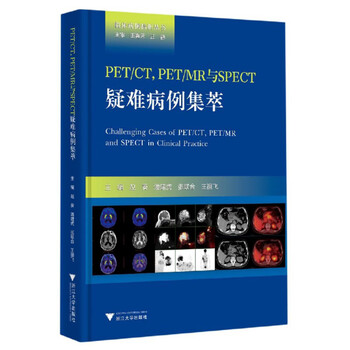 PET\CT PET\MR与SPECT疑难病例集萃/临床病例精析丛书