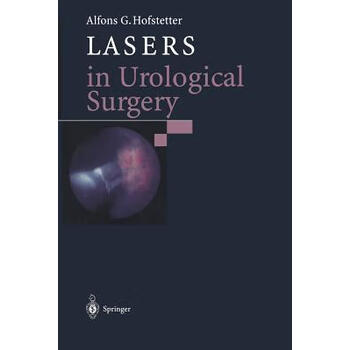 Lasers in Urological Surgery