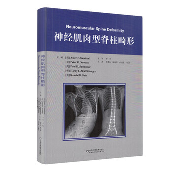 神经肌肉型脊柱畸形