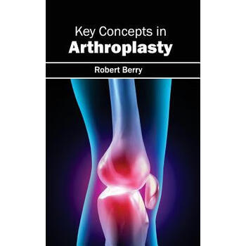 Key Concepts in Arthroplasty