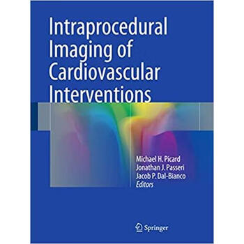 Intraprocedural Imaging of Cardiovascular Interv