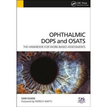 Ophthalmic Dops and Osats: The Handbook for Work