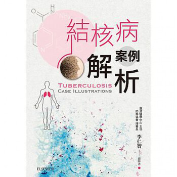 结核病案例解析