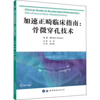 加速正畸临床指南:骨微穿孔技术