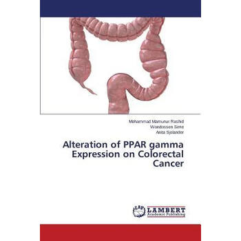 Alteration of Ppar Gamma Expression on Colorecta