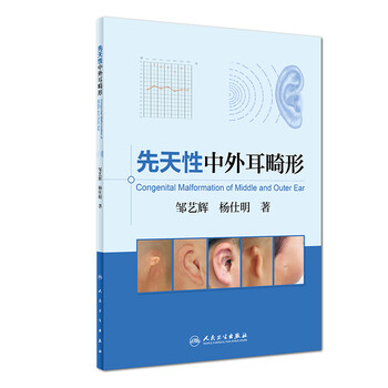 先天性中外耳畸形