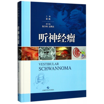 听神经瘤(精)