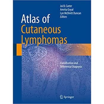 Atlas of Cutaneous Lymphomas: Classification and