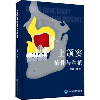 上颌窦植骨与种植