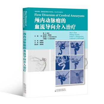 颅内动脉瘤的血流导向介入治疗