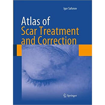 Atlas of Scar Treatment and Correction