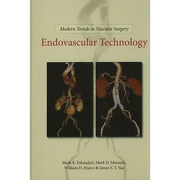 Endovascular Technology