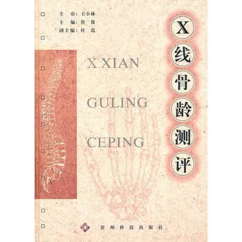 X线骨龄测评 焦俊　主编