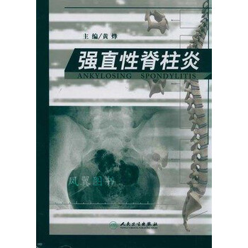 强直性脊柱炎 黄烽著 人民卫生出版社