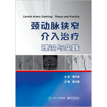 颈动脉狭窄介入治疗:理论与实践