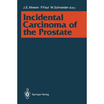 Incidental Carcinoma of the Prostate