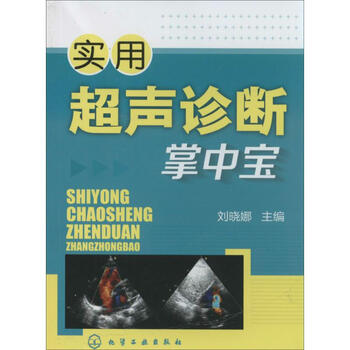 实用超声诊断掌中宝  作 刘晓娜 主编 书籍