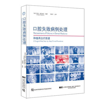口腔失败病例处理种植再图谱医学