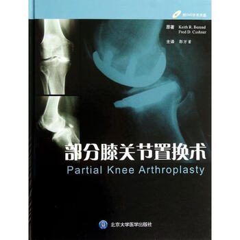 部分膝关节置换术