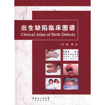 出生缺陷临床图谱 周沫 作 书籍