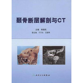 颞骨断层解剖与CT 韩德民 人民卫生 9787117093712