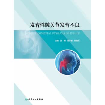发育性髋关节发育不良