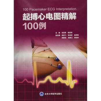 起搏心电图精解100例