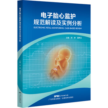 电子胎心监护规范解读及实例分析