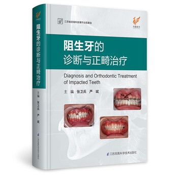 阻生牙的诊断与正畸治疗(精)