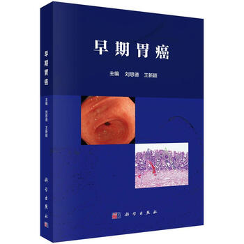 包邮：早期胃癌 医学   图书