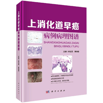 上消化道早癌病例病理图谱(精)