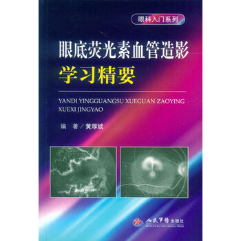 眼底荧光素血管造影学习精要.眼科入门系列