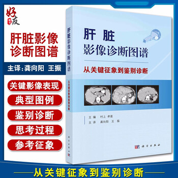 肝脏影像诊断图谱—从关键征象到鉴别诊断 临床影像 阐述了从关键影像表现引导到鉴别诊断的思考过程 书籍
