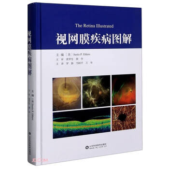 正版 视网膜疾病图解 9787572307089