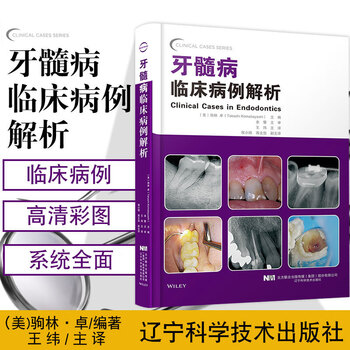 牙髓病临床病例解析