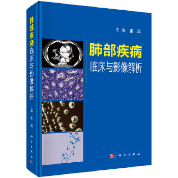 肺部疾病临床与影像解析 张嵩 科学出版社 9787030565556