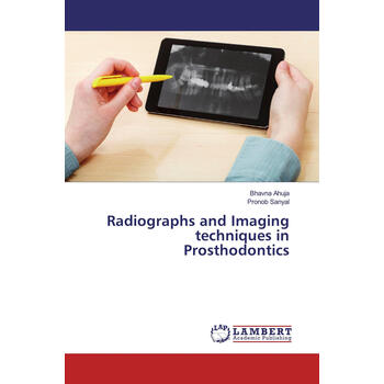 Radiographs and Imaging techniques in Prosthodon