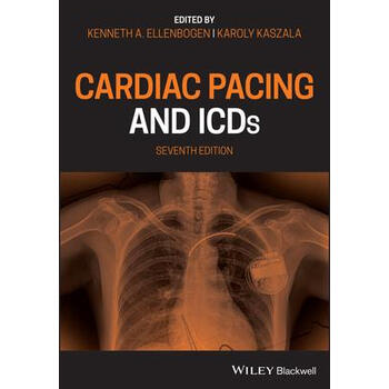Cardiac Pacing and Icds