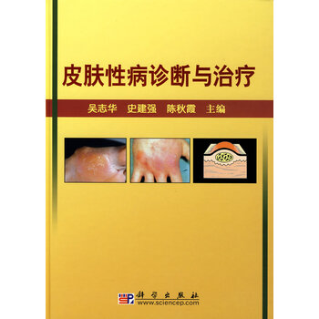 皮肤性病诊断与治疗【正版图书】