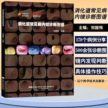 消化道常见病内镜诊断图谱 刘国伟 消化系统疾病诊断图片案例分析 消化道内窥镜检图谱 内科医师 辽宁