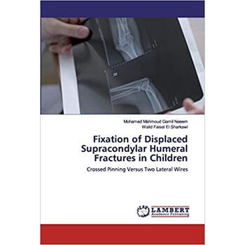 Fixation of Displaced Supracondylar Humeral Frac