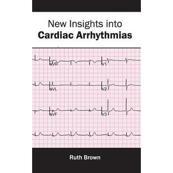 New Insights Into Cardiac Arrhythmias