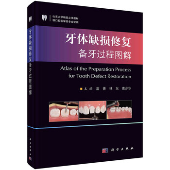 [正版图书]牙体缺损修复备牙过程图解