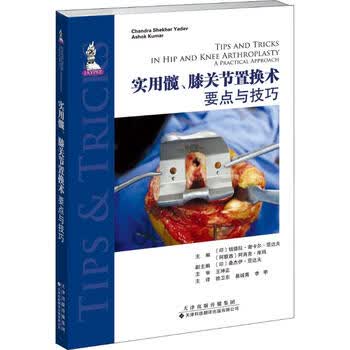 实用髋、膝关节置换术 要点与技巧