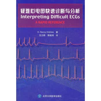 疑难心电图快速诊断与分析
