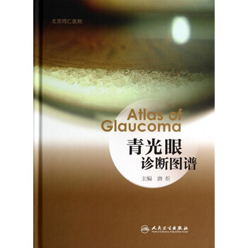青光眼诊断图谱(精)