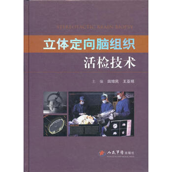 立体定向脑组织活检技术