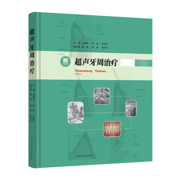 超声牙周治疗