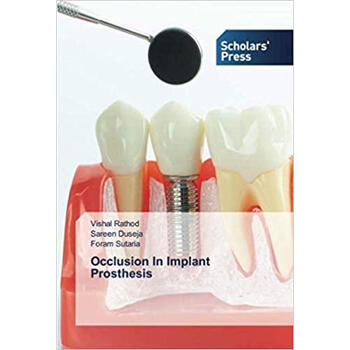 Occlusion In Implant Prosthesis