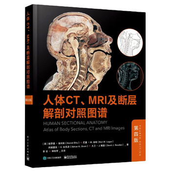 人体CT\MRI及断层解剖对照图谱(第4版)
